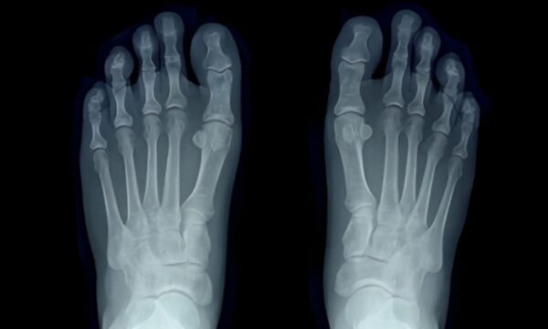 Exploring CT Scans for Bone Imaging - Kiran Lab