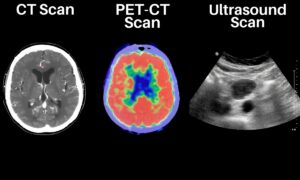 Various Types of Scanning: What are Scans? - Kiran Lab