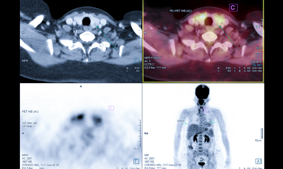 What Can CT Scans Detect? - Kiran Lab