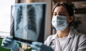 When to Consider a Full Body PET Scan: A Comprehensive Guide