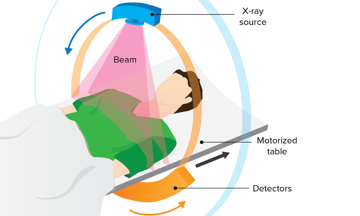 What Can CT Scans Detect? - Kiran Lab