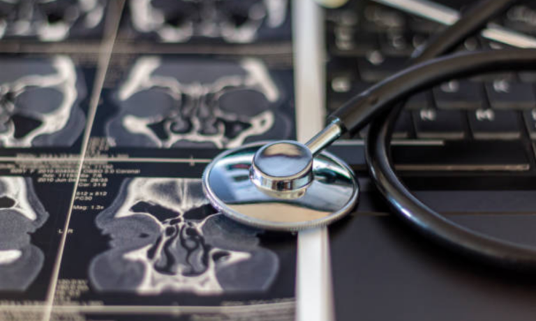 What Is a Sinus CT Scan? Key Facts and Benefits