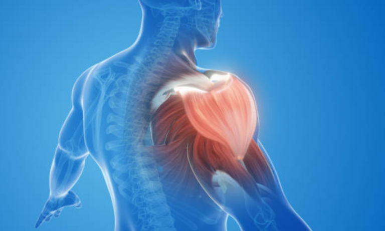 How a CT Scan Detects Muscle Strain