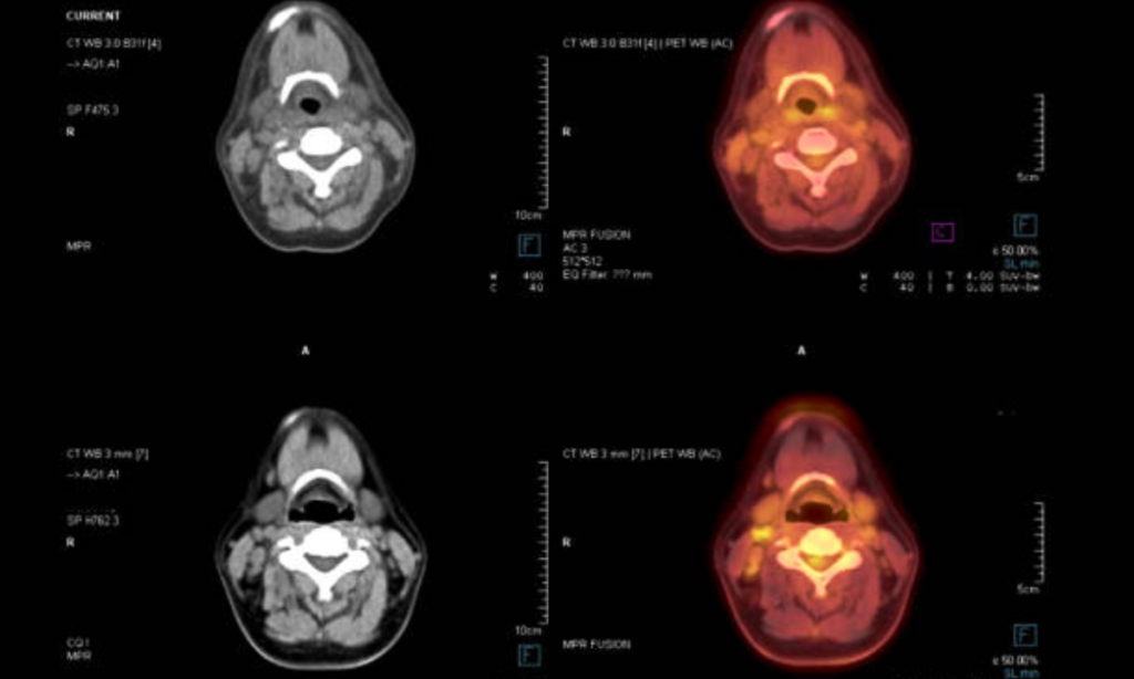 Exploring the Best Imaging Techniques for Thyroid Disorders