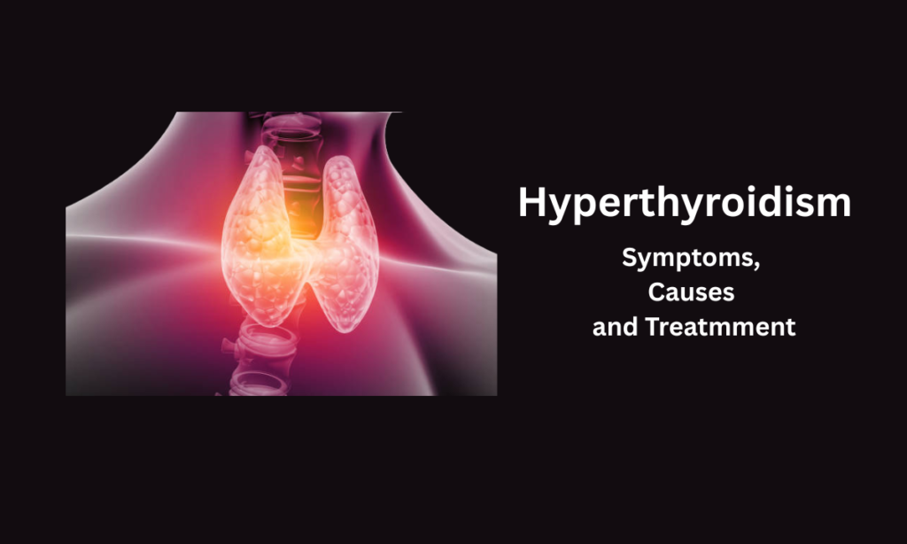 Hyperthyroidism: Symptoms, Causes, and Treatment