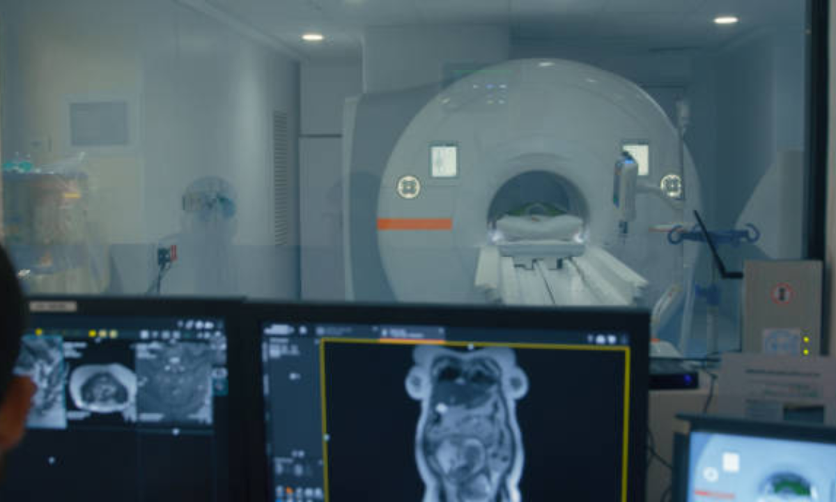 DMSA Scan: Purpose, Procedure, and What to Expect