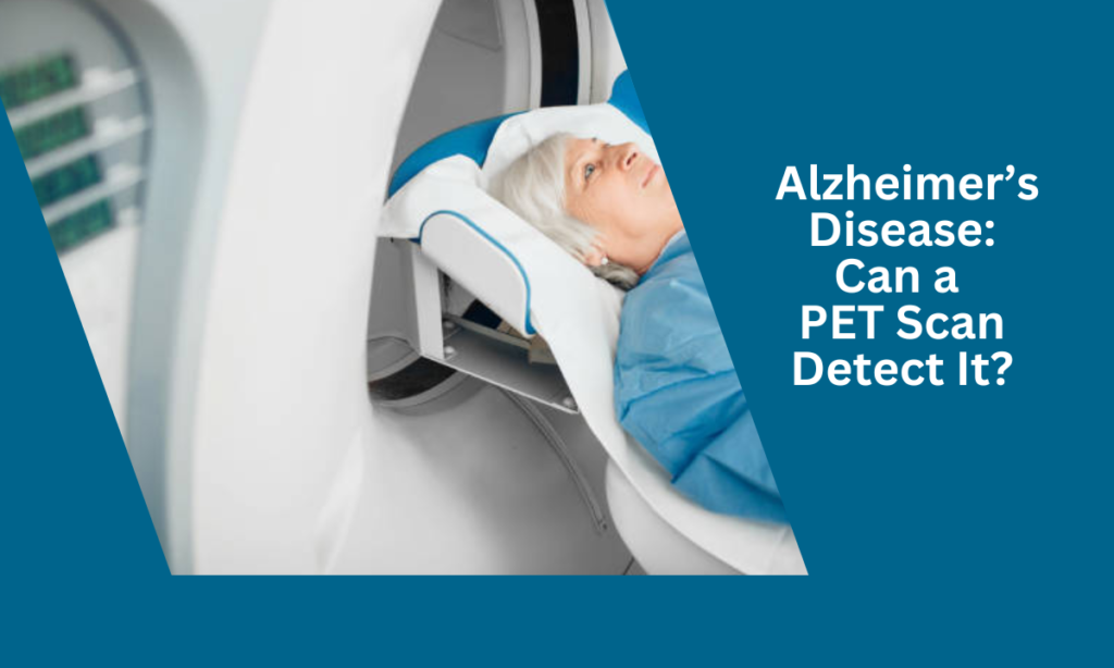 Early Signs of Alzheimer's Disease: Can a PET Scan Detect It?