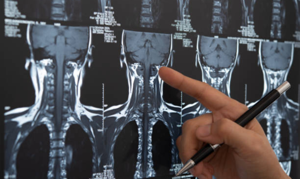 Everything You Should Know Before a Neck CT Scan