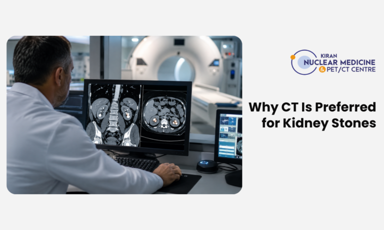 Why CT Scan is Preferred for Kidney Stones?